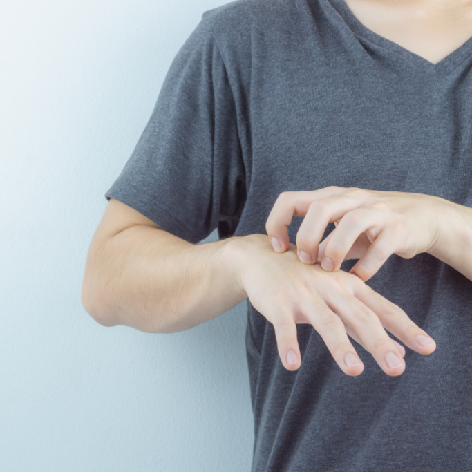 Eczéma traitement : comment traiter et soulager l’eczéma | Dexeryl Gamme